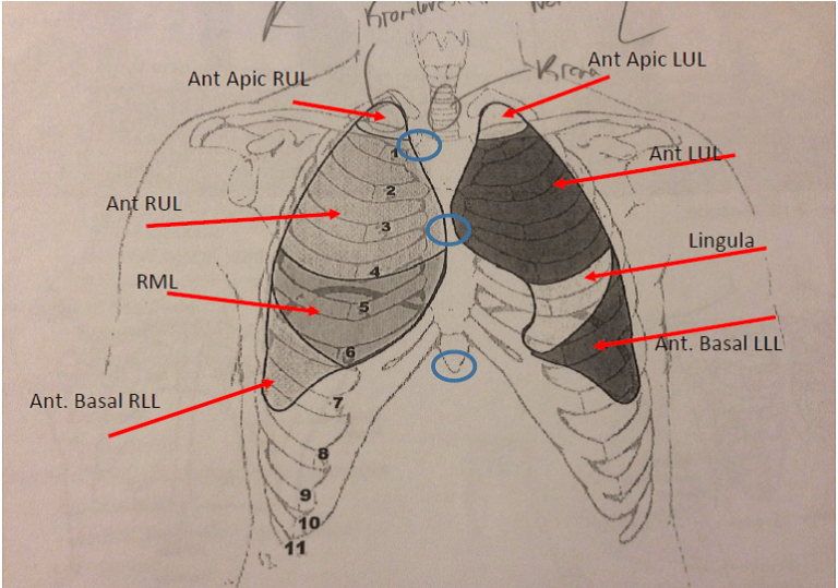 Lung Auscultation – Physical Therapy Reviewer
